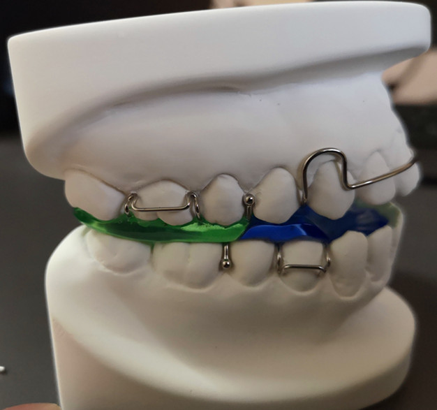 Dental Orthodontic Appliance - ZHO